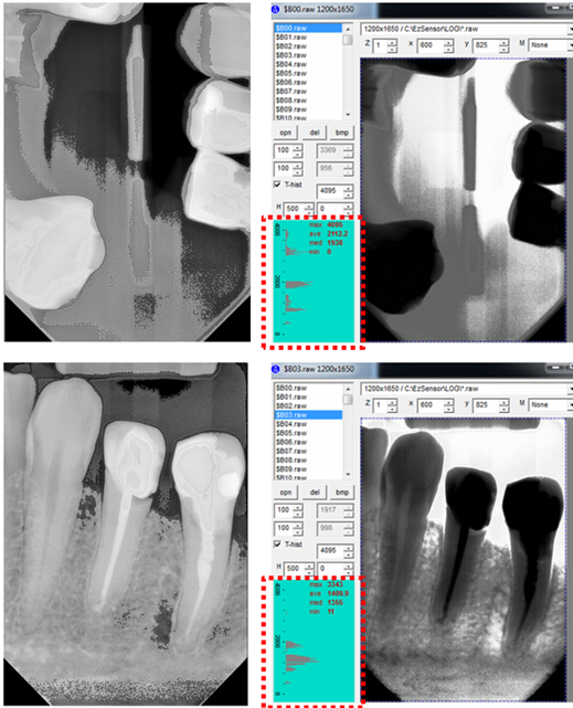 [EzSensor Classic] Bit Loss Image (Pixelation)